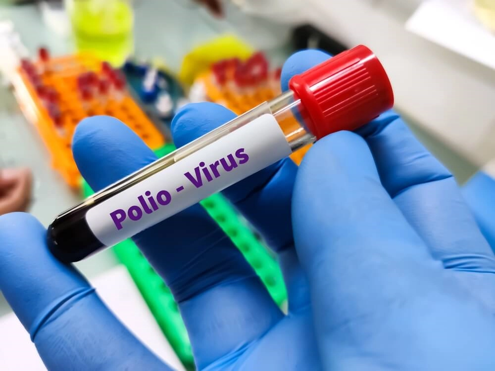 Wirus polio wykryty w Niemczech - aktualne informacje